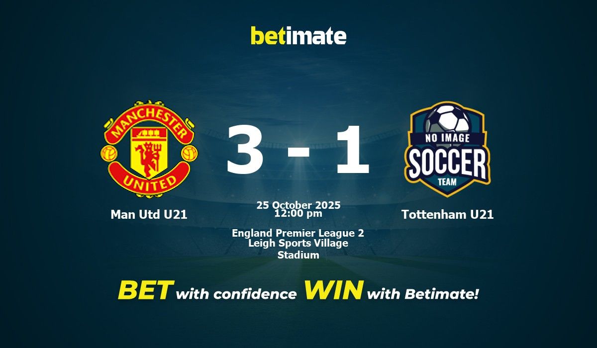 Predicción, cuotas y consejos de apuestas del Manchester United Sub-21 ...